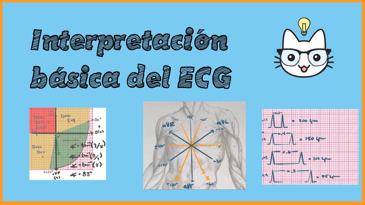Interpretación Básica del ECG: ¡Aprende Fácil con FREOSI!