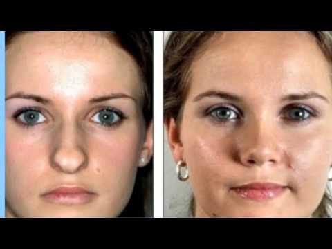 (855) 622-4466 Best Rhinoplasty Surgeon Memphis TN | Top Nose Job Surgeons Tennessee