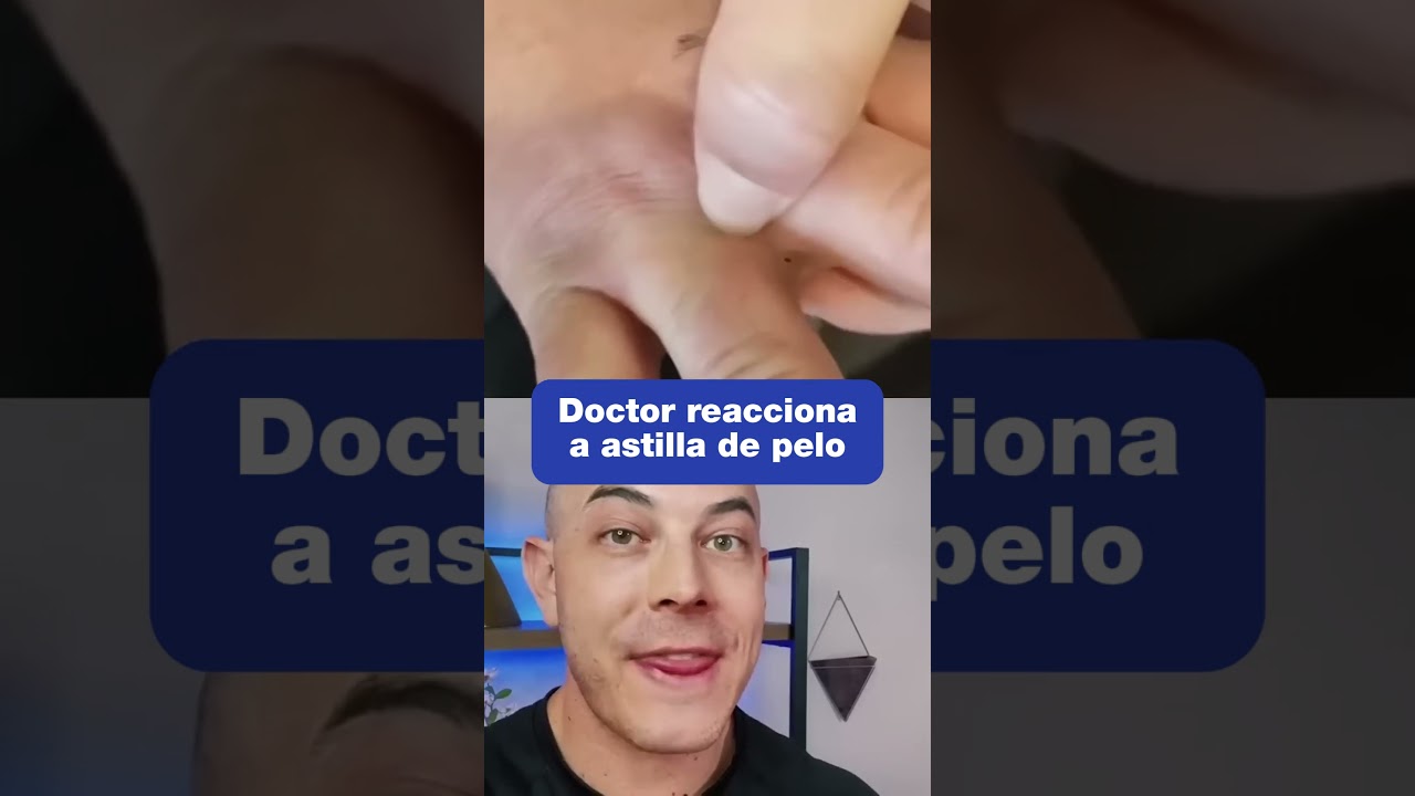 Dermatologist reacts to large hair splinter! #barber #hairsplinter #dermatologistreacts