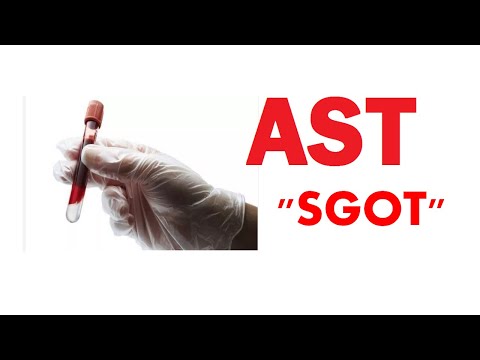 HIGH AST (SGOT) LEVELS : WHAT DOES IT MEAN ?