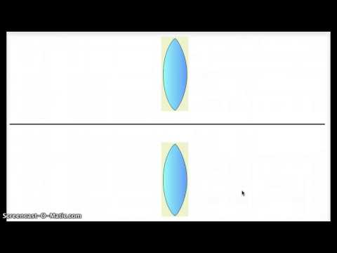 Each Person Has A Scoliosis. Part 1 of 3 – Dr.