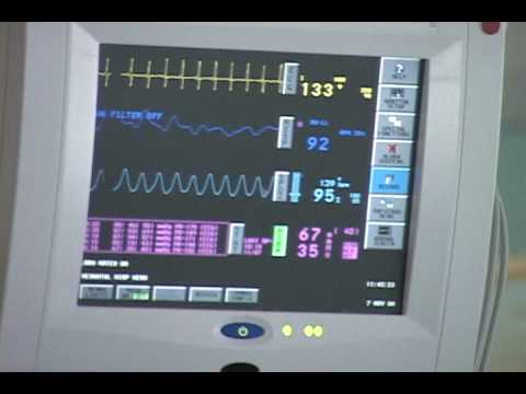 Increases in Male Nursing.