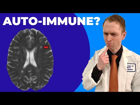 Is MS Actually Autoimmune?