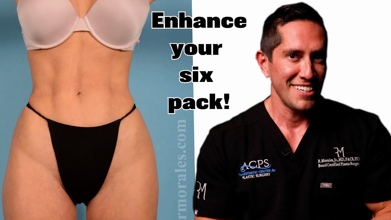 Give your six pack a boost with ab etching!