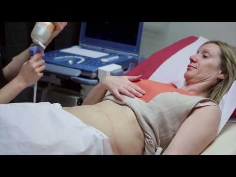 Abdominal Scan