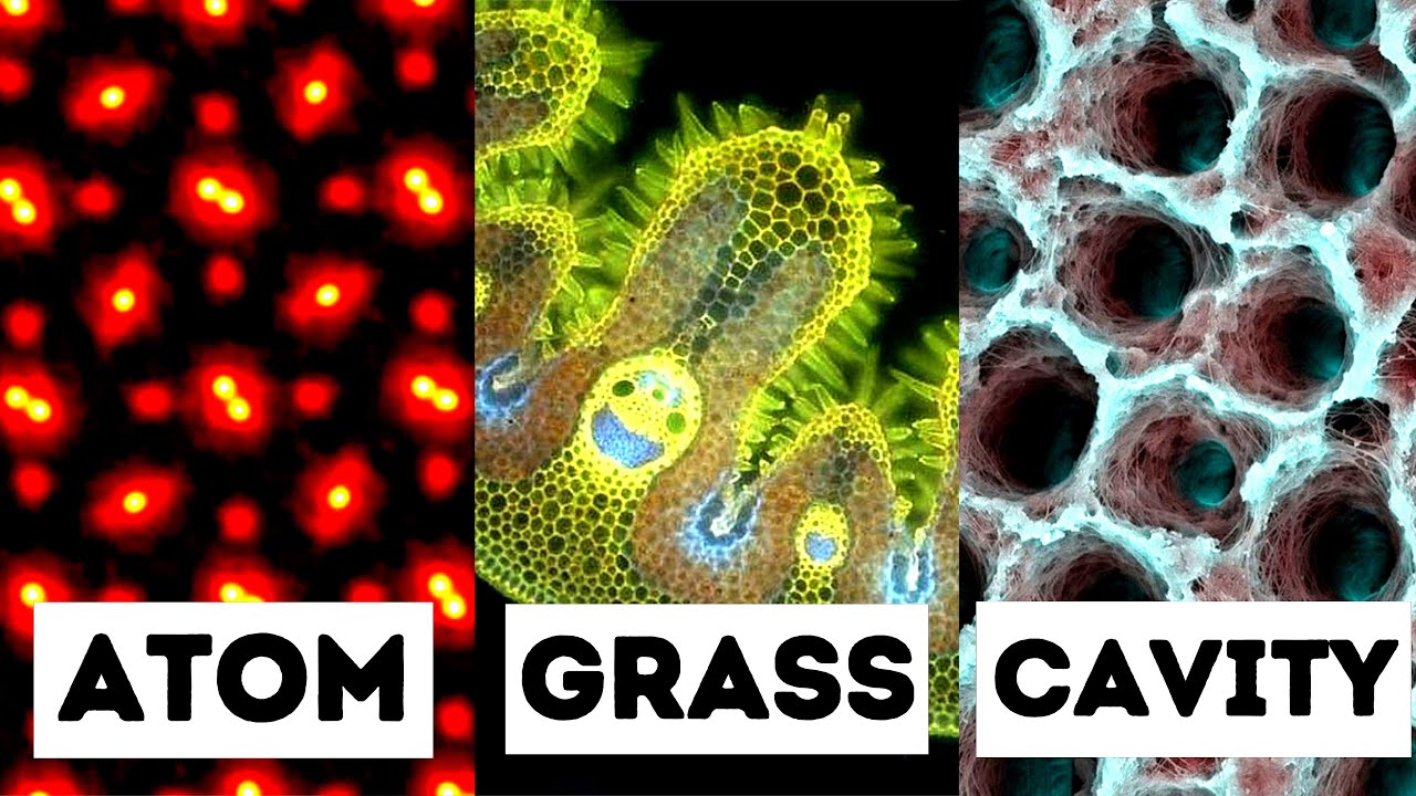 Stunning Objects Under Electron Microscope!