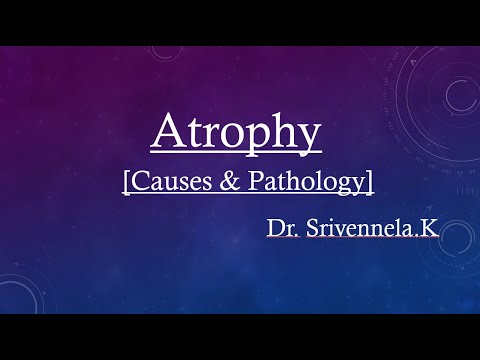 Atrophy [ Causes and Pathology ]