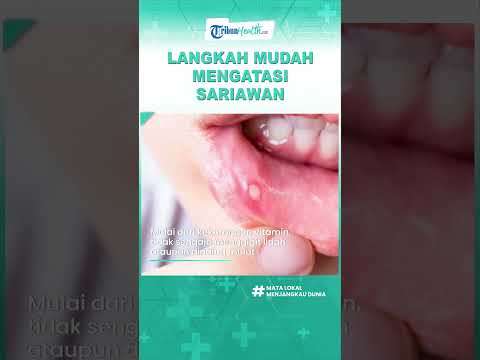 CARA MUDAH Atasi Sariawan, Ini Cara Alami yang Dapat Sobat Sehat Lakukan