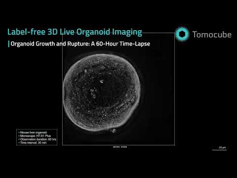 Mouse Liver Organoid Time Lapse - HT-X1 Plus Label-Free 3D Imaging