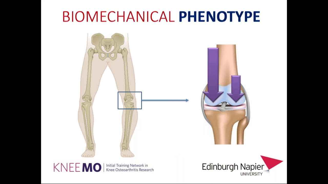 [Webcast] - Knee internal contact forces in the knee osteoarthritis population