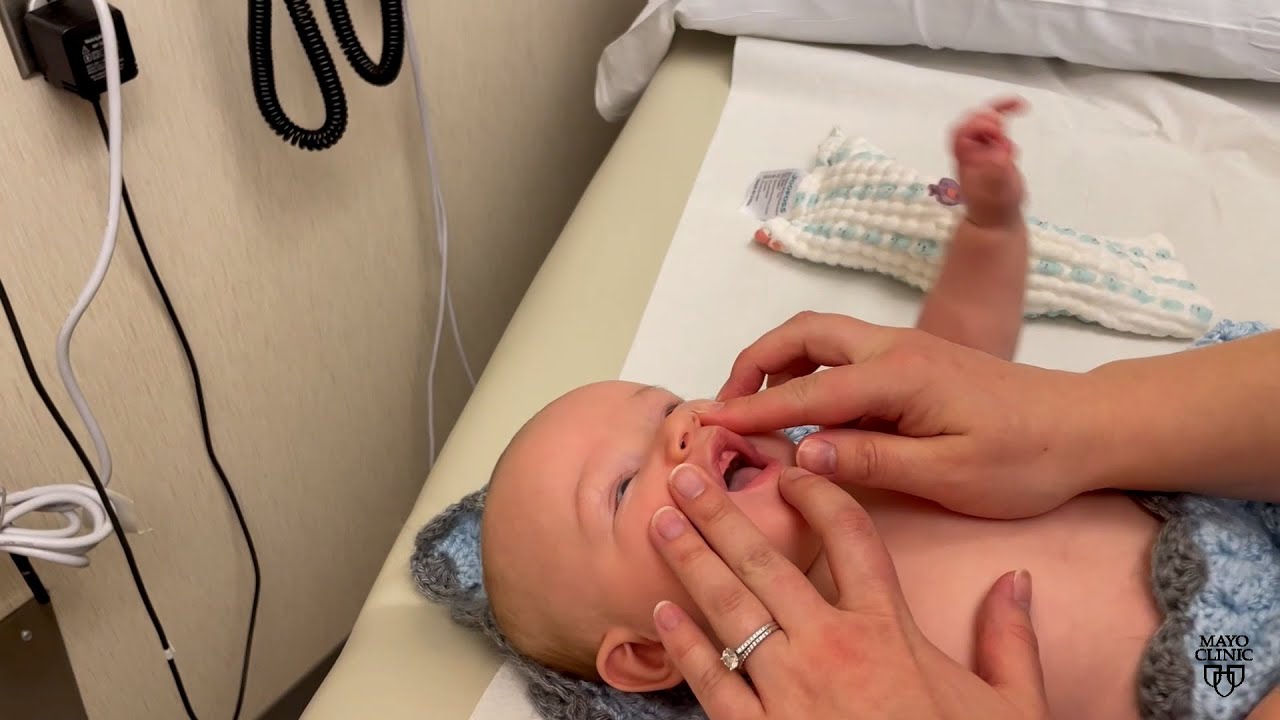 Mayo Clinic Minute: Tongue-tie in babies