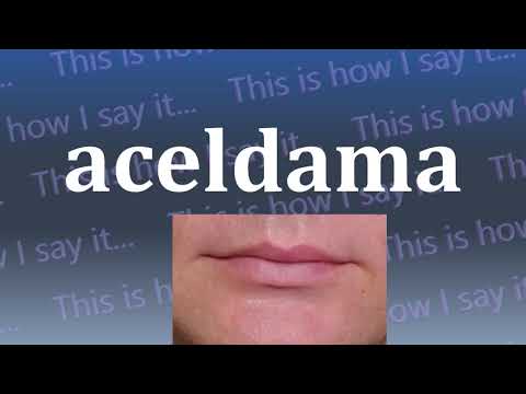 This is How I Say...aceldama