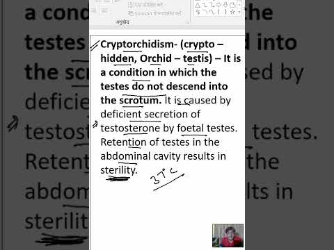 Cryptorchidism- (crypto – hidden, Orchid – testis) – It is a condition in which the testes do not
