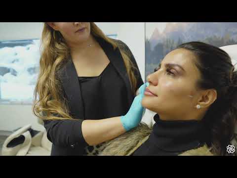 FORM SPA | Cheek Filler