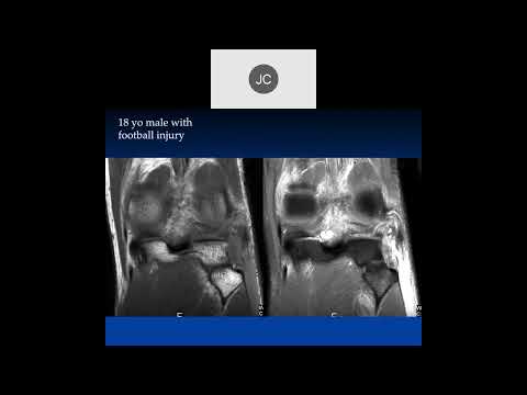 MRI of the Knee Ligaments | Part 1, 2023