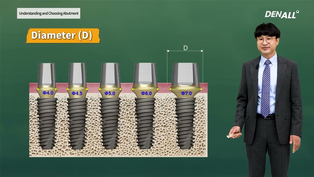 [Master Course - BASIC] ep 27 Understanding and Choosing Abutment