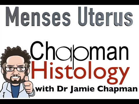3 Minute Histology - Menses Uterus
