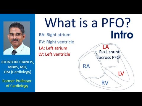 What is a PFO? Intro