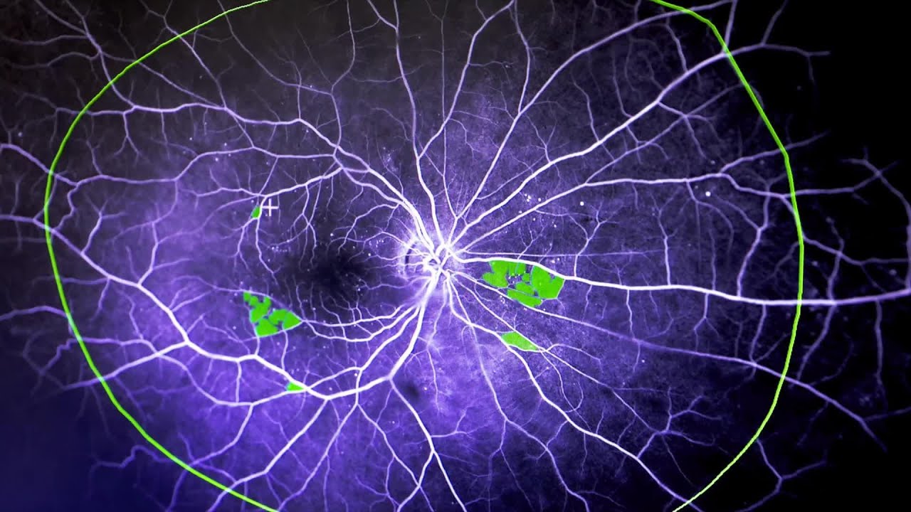 Cleveland Clinic Innovators Advance Ophthalmic Imaging with AI-Driven Technology