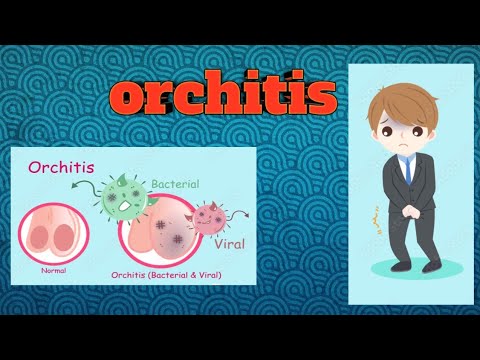 orchitis |pronunciation |definition| causes|symptoms