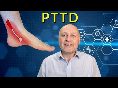 Posterior Tibial Tendon Dysfunction (PTTD). The best self help treatments.