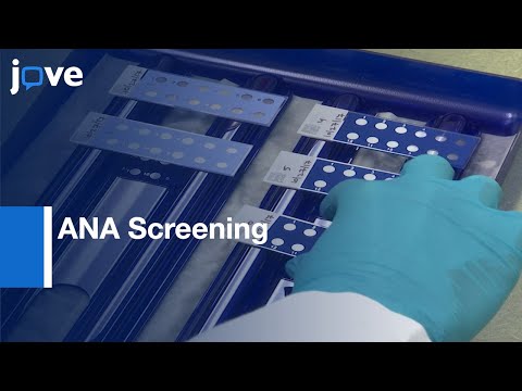 Monospecific and Mixed DFS70 Patterns Distinction during ANA Screening | Protocol Preview