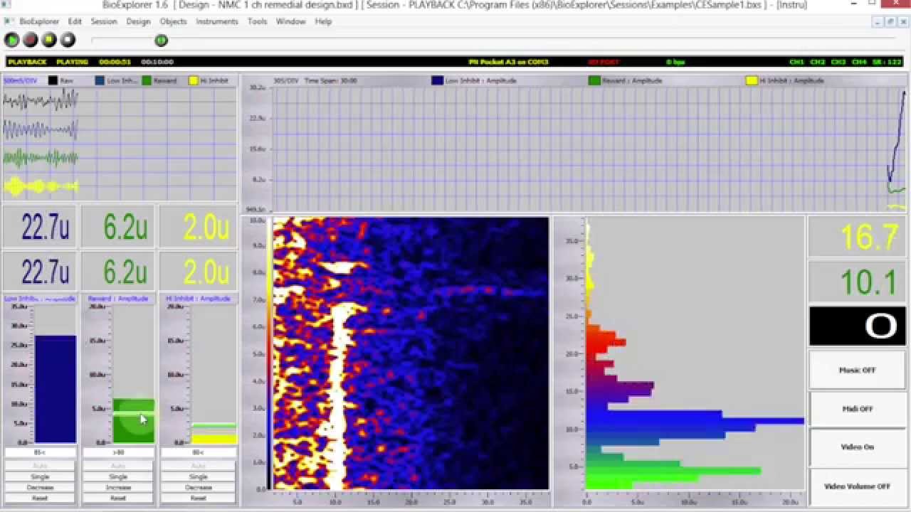 NMC 1 Channel Remedial Template