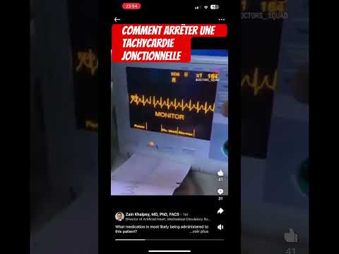 La vidéo à voir sur comment une tachycardie jonctionnelle de Bouveret est arrêtée !