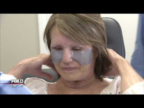 BRUISE REMEDY AFTER BLEPHAROPLASTY