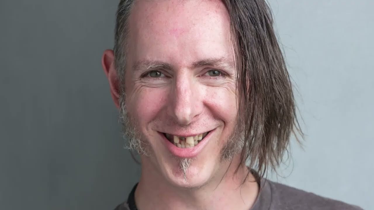 Tom's Transformative Smile Journey: All-on-X Dental Implants & Sobriety | A Second Chance