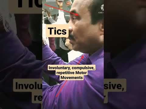 Tics- Involuntary, compulsive, repetitiveย motor movements #mbbs #medicine #neetpg #neet #usmle