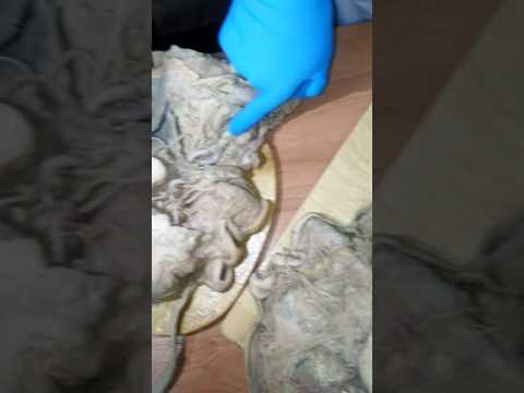 Carotid and Subclavian arteries explanation (Latin)