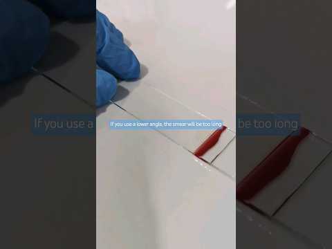 All about Blood Smear PART 1 #hematology #bloodsmear #laboratory #mls #cls #medtechstudent #medtech