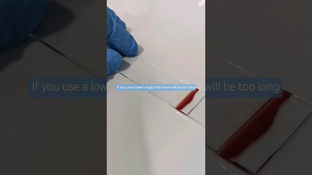 All about Blood Smear PART 1 #hematology #bloodsmear #laboratory #mls #cls #medtechstudent #medtech