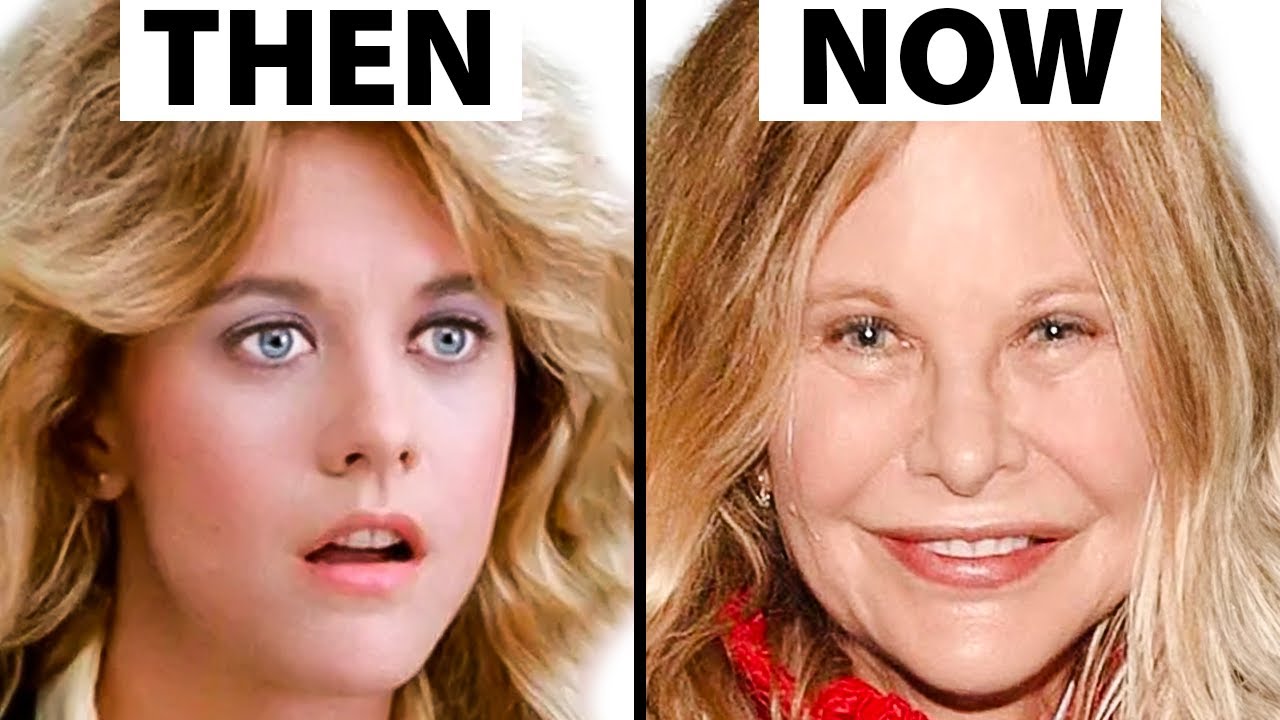 Meg Ryan's NEW FACE | Plastic Surgery Analysis