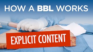 Big Bbl Watch HD Mp4 Video Download Free