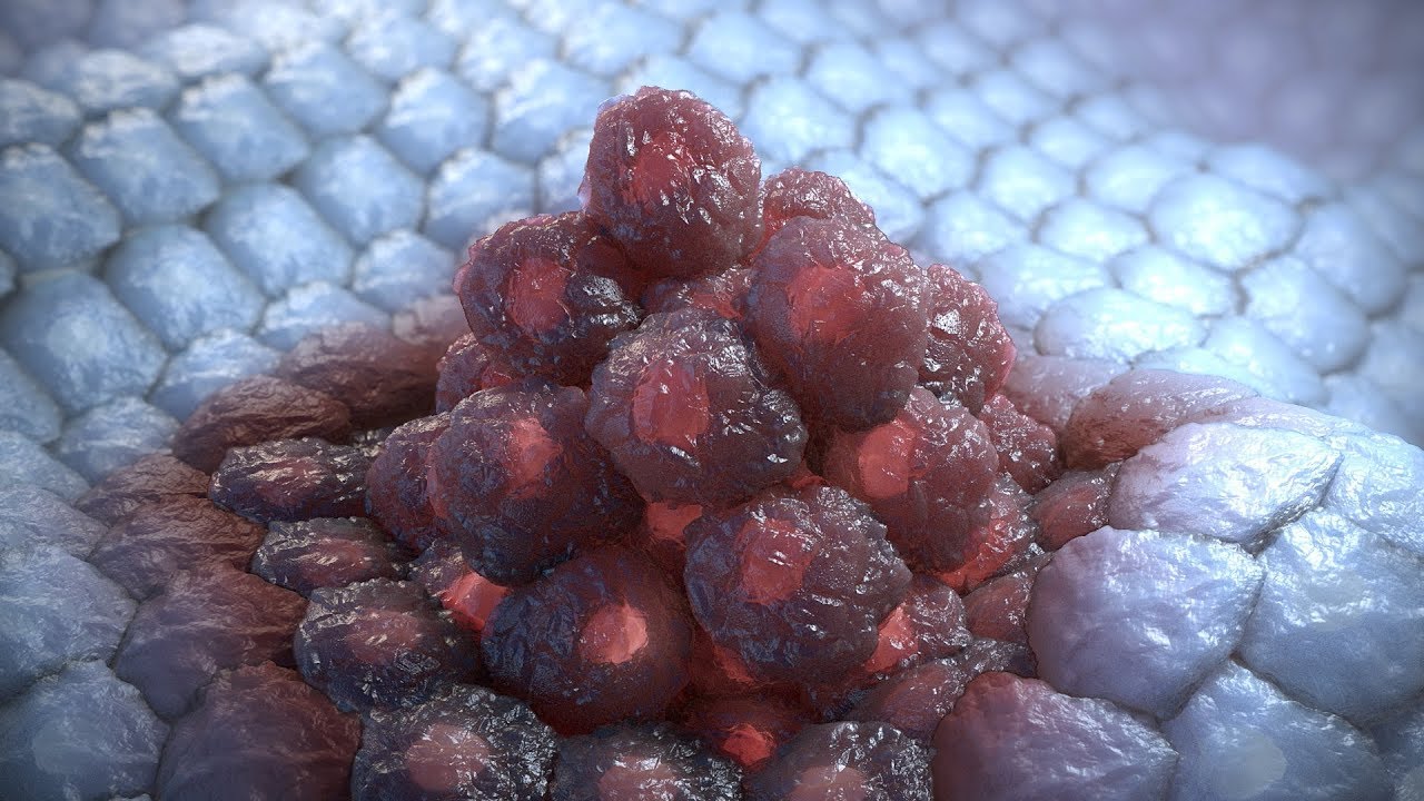 Random42 Science in Motion - Cancer Pathways