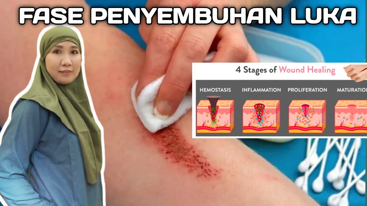 PROSES PENYEMBUHAN LUKA DARI AWAL SAMPAI SEMBUH
