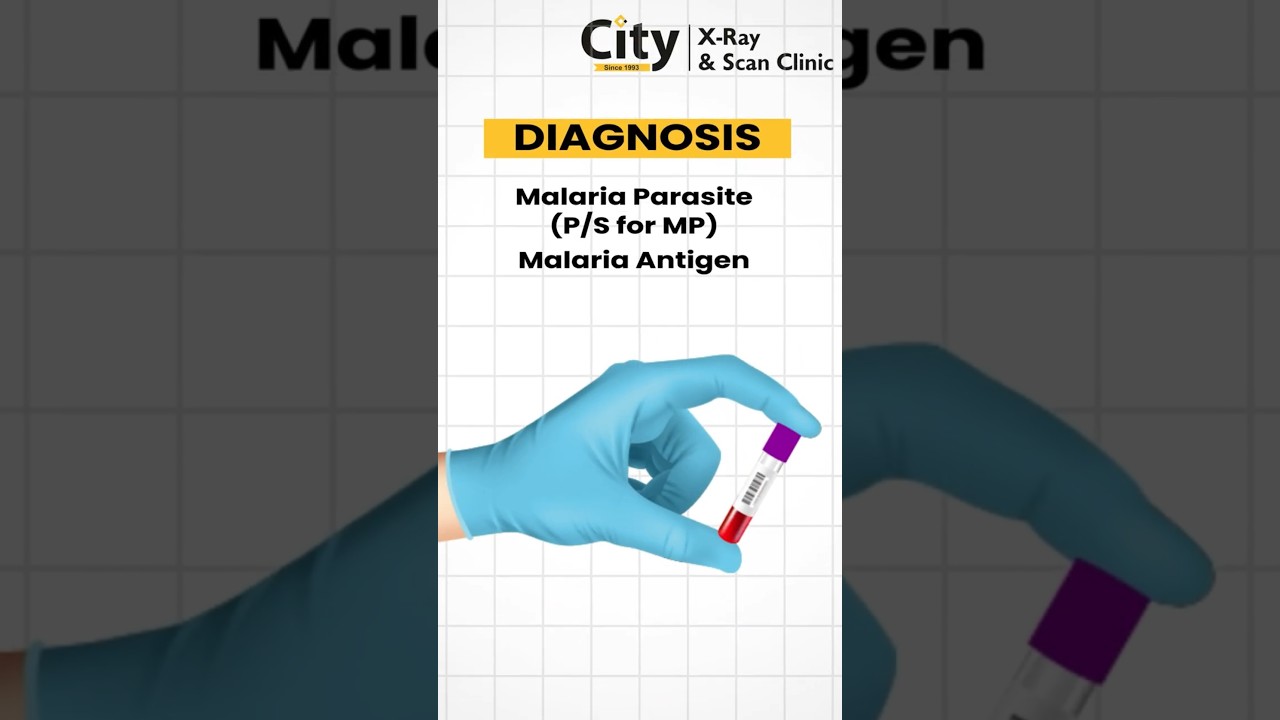 World Malaria Day 2024: Symptoms, Prevention & Diagnosis | City X-Ray & Scan Clinic