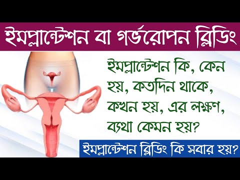 ইমপ্লান্টেশন ব্লিডিং | ইমপ্লান্টেশন ব্লিডিং কখন হয় | Implantation bleeding koto din thake