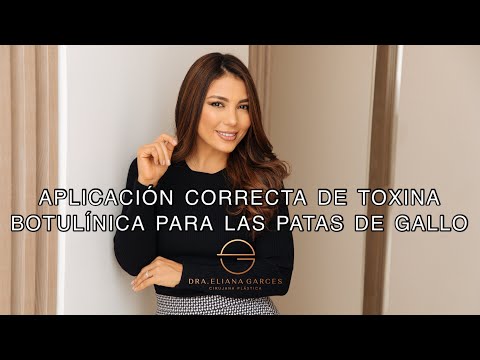 APLICACIÓN CORRECTA DE TOXINA BOTULÍNICA PARA LAS PATAS DE GALLO