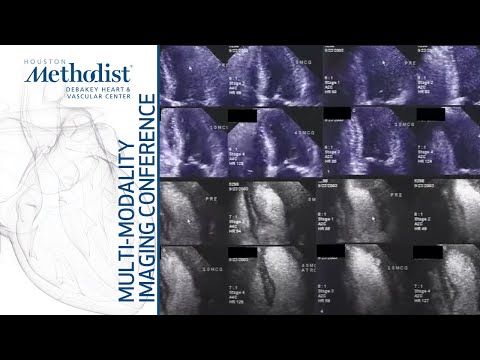 The Role of Stress Echocardiography: Ischemia Evaluation & Beyond (M. Quinones MD) December 14, 2021