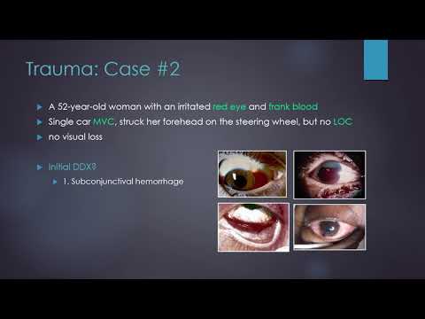 Trauma of the Anterior Segment Part 1