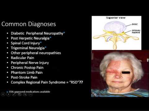 Brett Stacey, M.D.- Neuropathic Pain: Overview, Guldelines, Databases, and Procedure