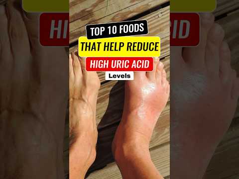 ✅Top 10 Foods To Reduce High Uric Acid Levels #Uric acid diet #Gout diet