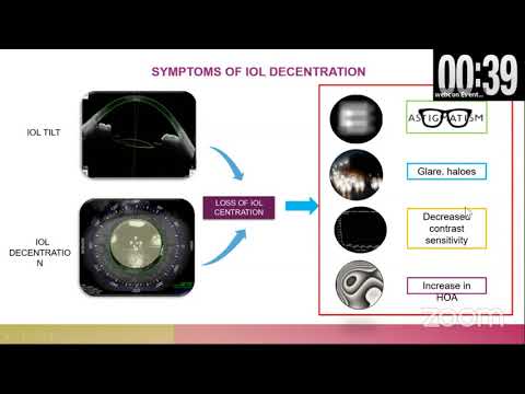AIOC2021 - IC416 - Topic - Dr.RAVI KRISHNA KANARADI