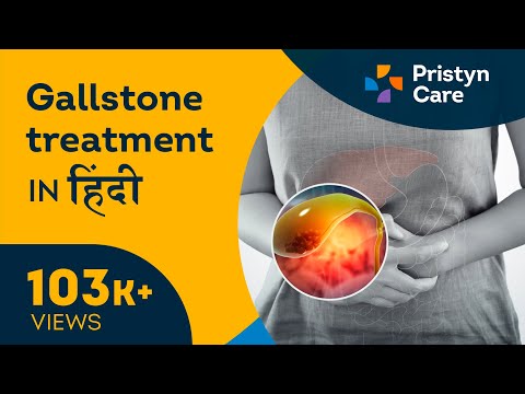 Gall Stone symptoms | Gallstone Treatment in Hindi | For Free Consultation Call Now - 08065105263
