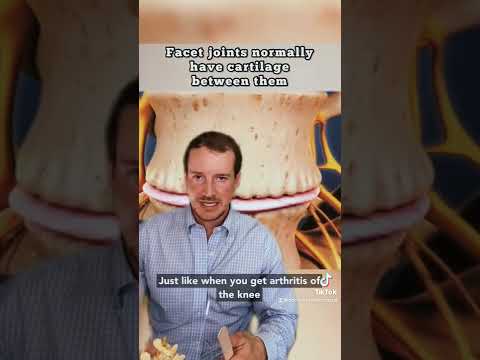 What is Spinal Stenosis??