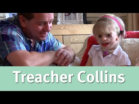 My daughter has Treacher Collins syndrome