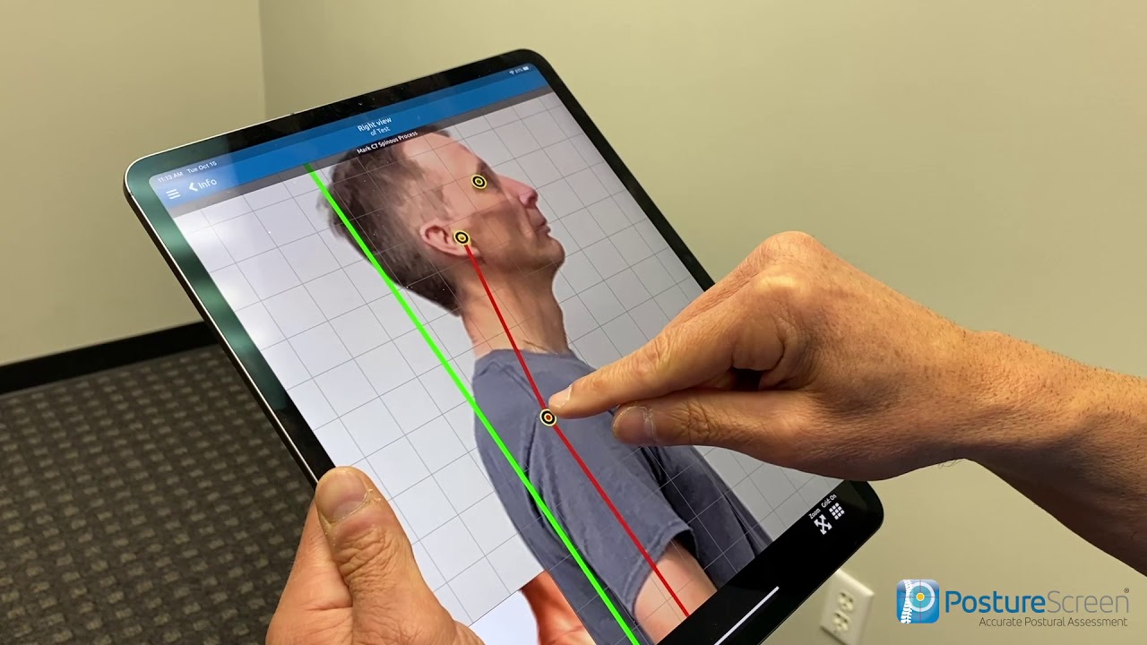 PostureScreen Augmented Reality Assisted Posture Assessment - 4 View Tutorial
